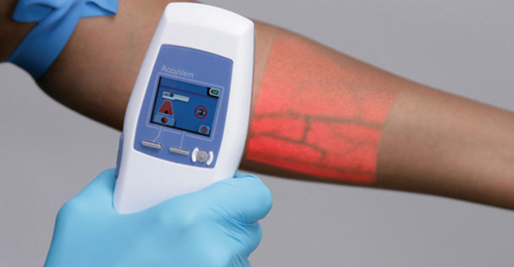 Vein Finder | Your Vein Finder Expert Vein Finder | Your Vein Finder Expert